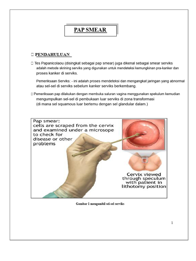 Panduan Lengkap Pap Smear dan Prosedurnya | PDF