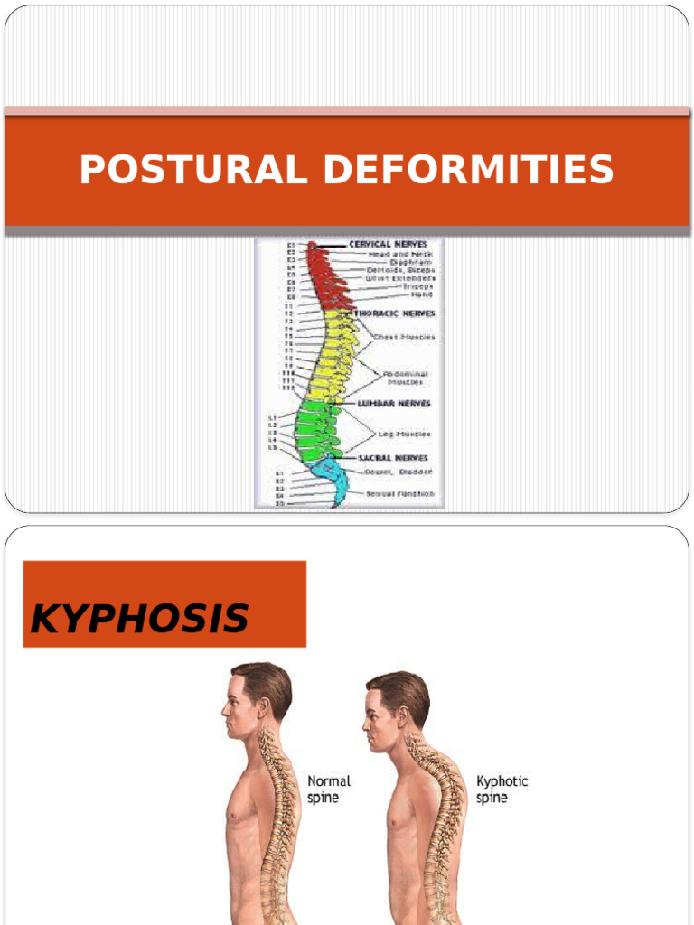 Understanding Postural Deformities | PDF | Scoliosis | Knee