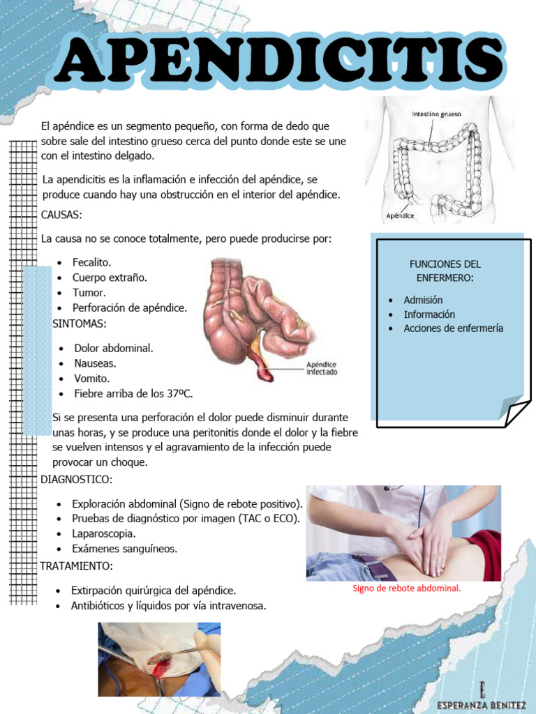 Resumen Apendicitis Pdf