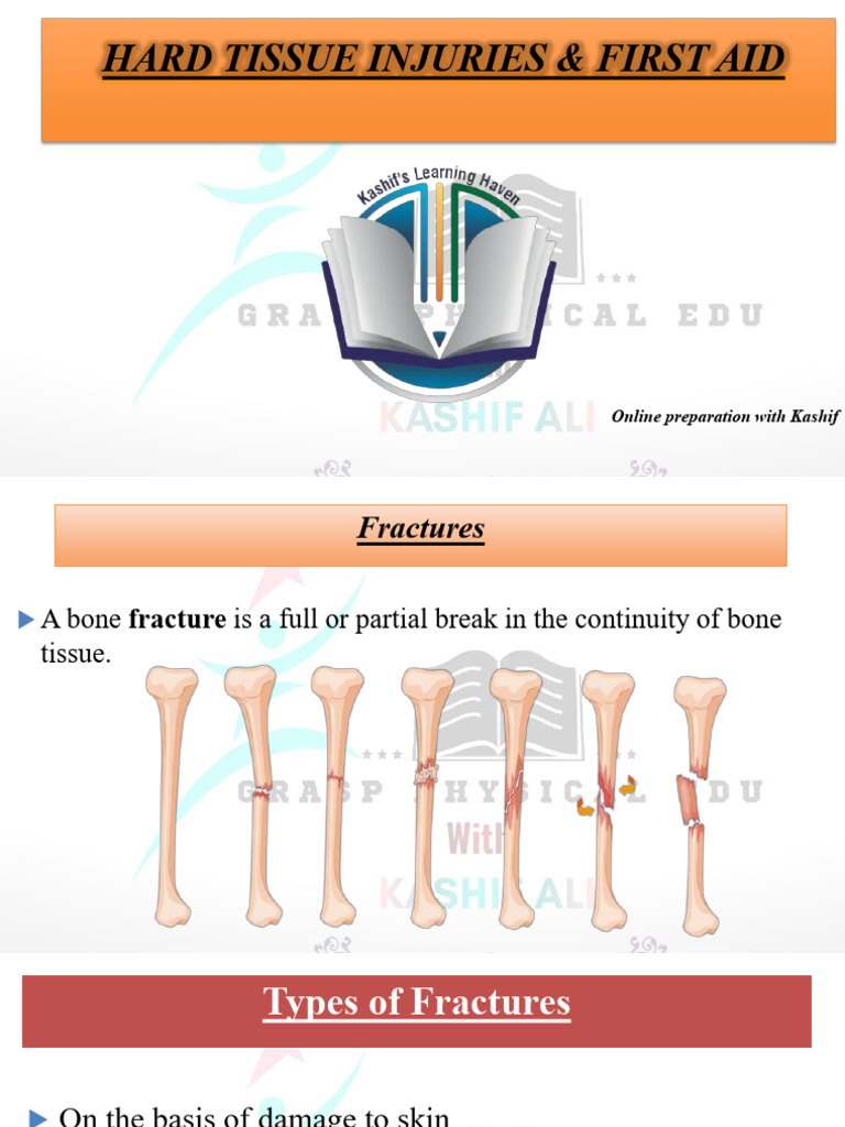 Sports Medicine , Lec 2 , Hard Tissue Injuries and First Aid | PDF ...