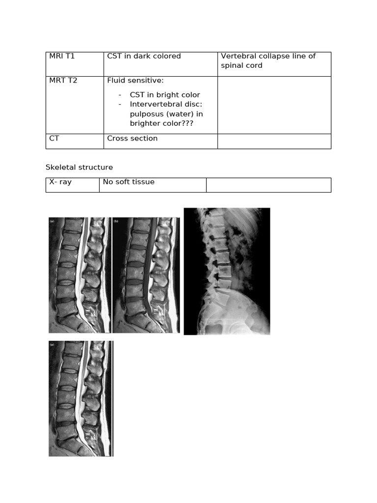 MRI CT Xray | PDF