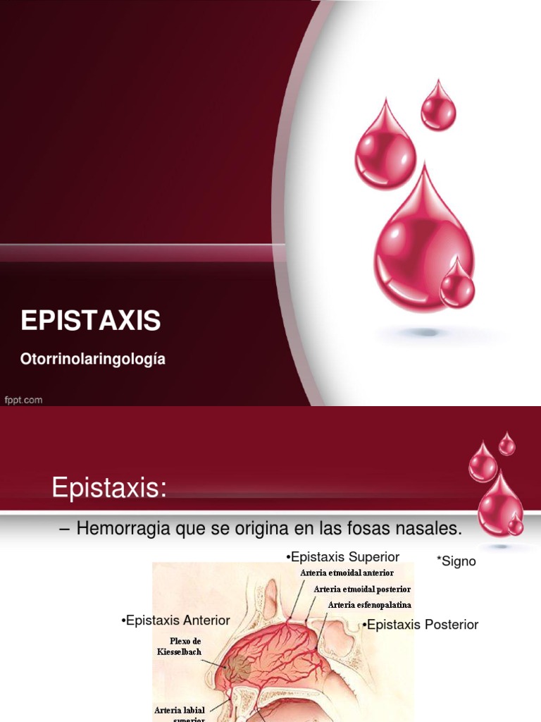 Epistaxis | PDF | Ciencias de la Salud | Especialidades Medicas