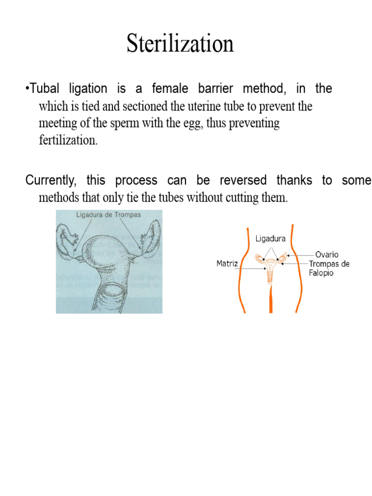 salpingectomy | PDF | Clinical Medicine | Surgical Specialties