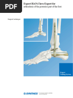 Advanced Tibial Nailing Techniques Guide | PDF | Knee | Screw