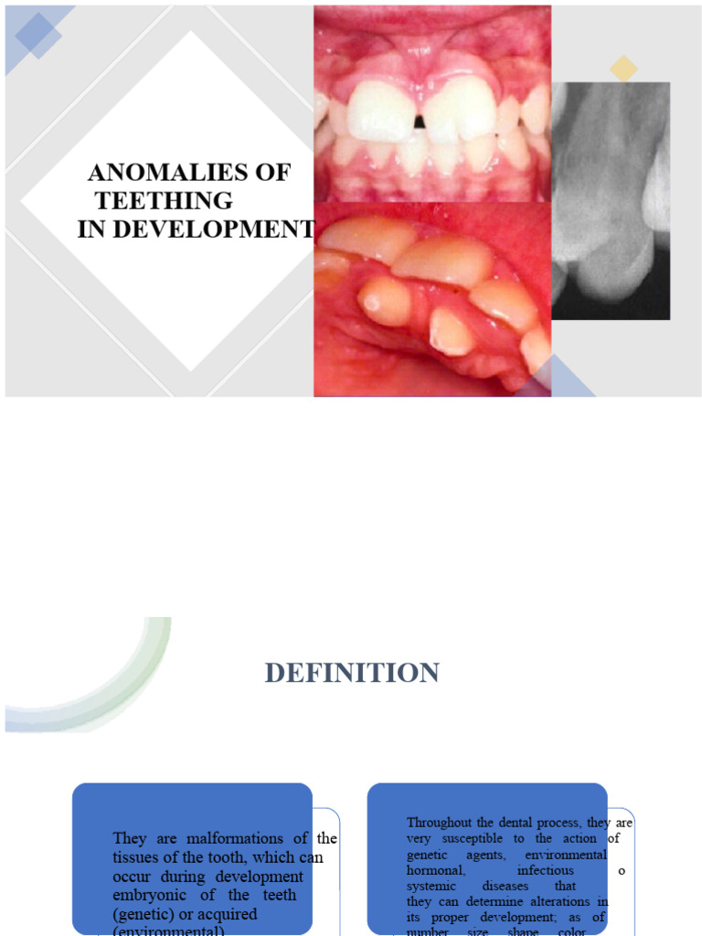 15 Anomalies of developing dentition | PDF | Human Tooth | Tooth