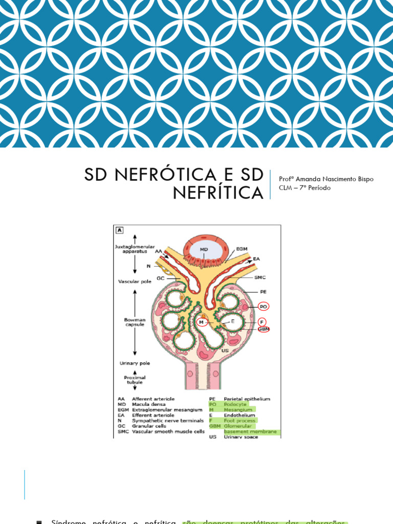 A3 - SD NEFRÓTICA E SD NEFRÍTICA_241203_110210 (1) | PDF | Doenças e ...