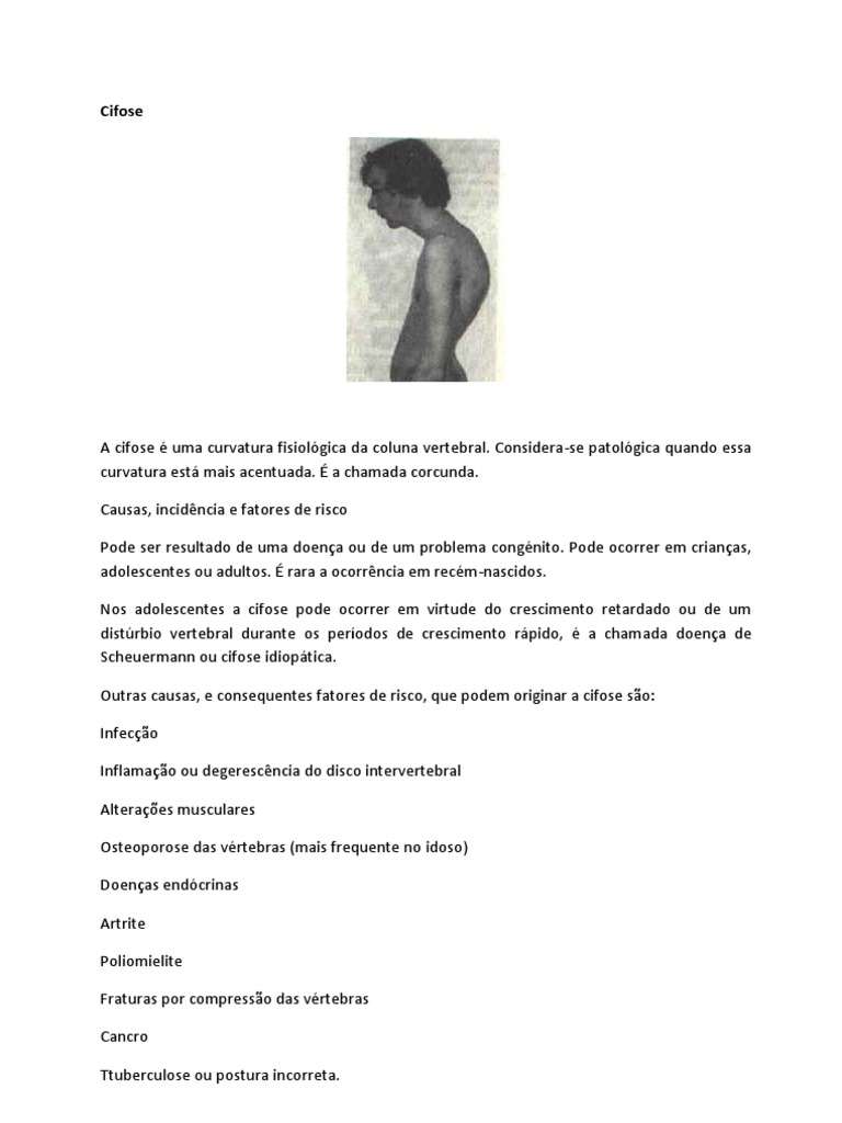 Cifose | PDF | Coluna vertebral | Vértebra