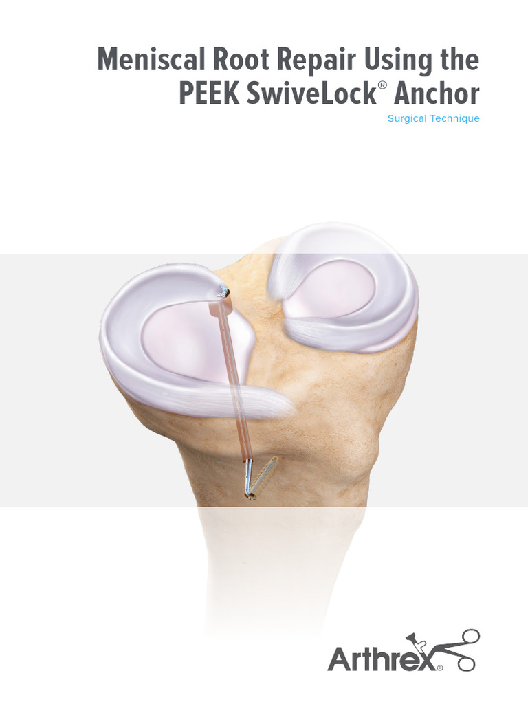 Meniscal Root Repair with PEEK Anchor | PDF