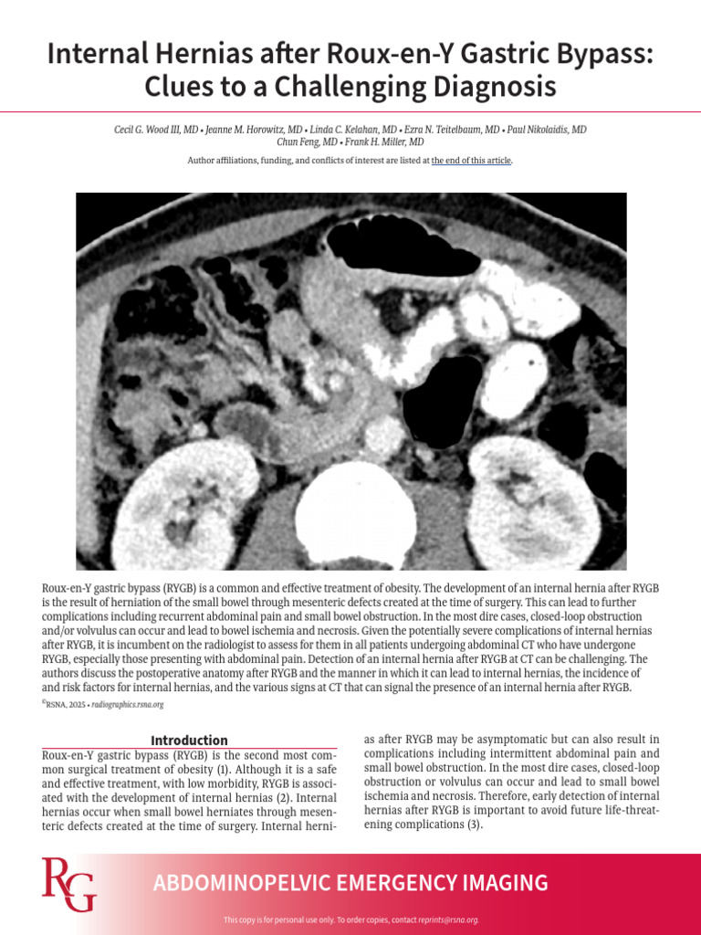 Internal Hernias Post-RYGB: Diagnosis Insights | PDF | Small Intestine ...
