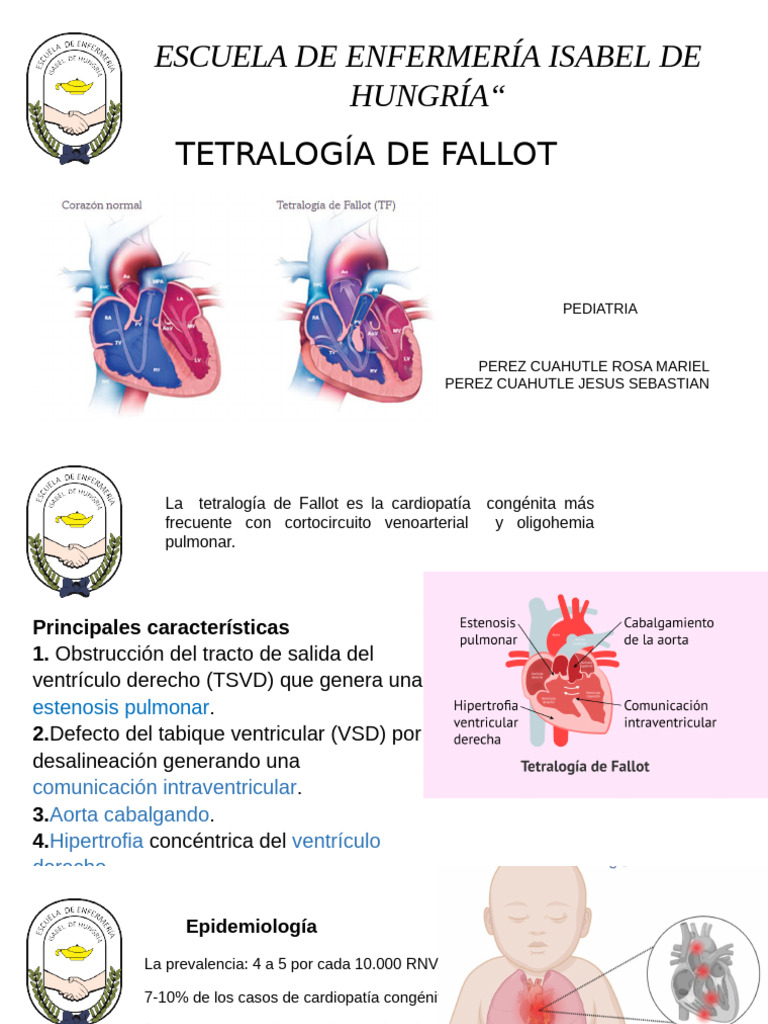 Tetralogía de Fallot | PDF | Corazón | Defecto cardiaco congenito