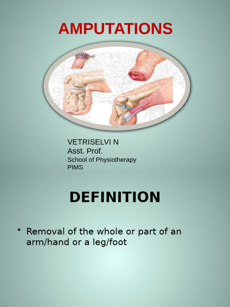 Understanding Amputations and Prosthetics | PDF | Amputation | Prosthesis