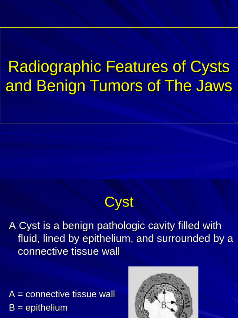 Radiographic Features of Jaw Cysts | PDF
