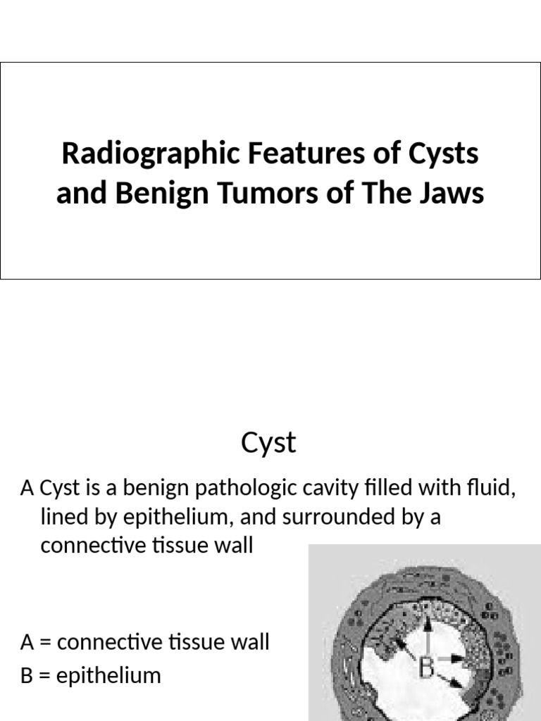 DSC Radiographic Cysts&Tumor | PDF | Diseases And Disorders