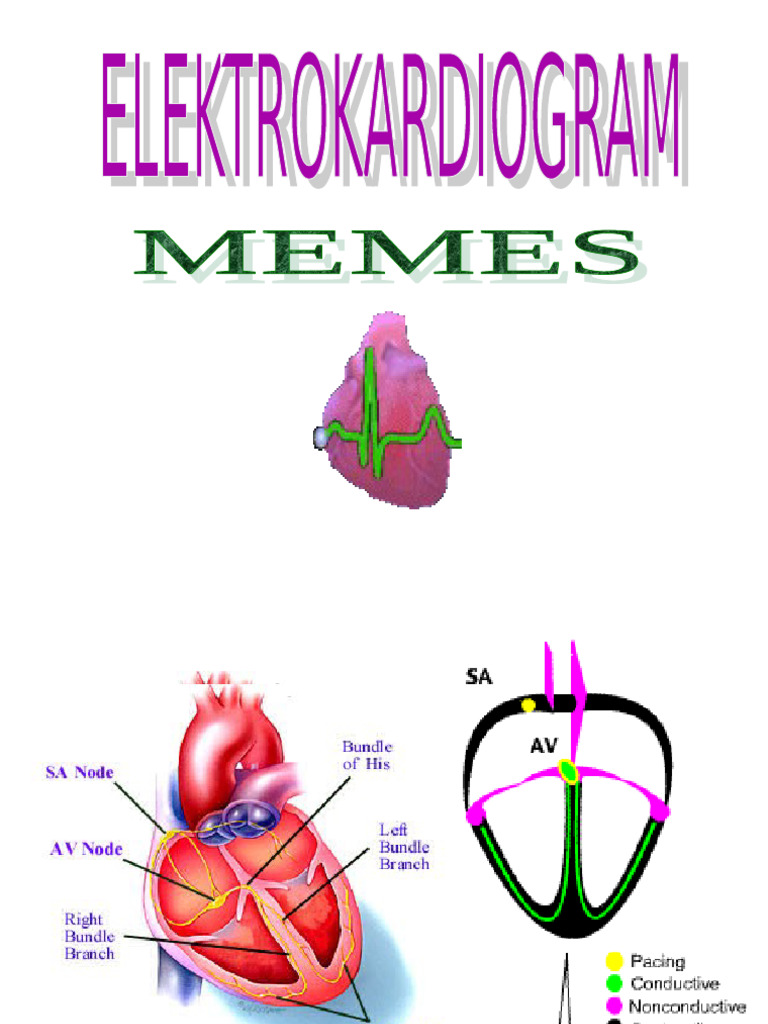 Dasar Dasar EKG | PDF