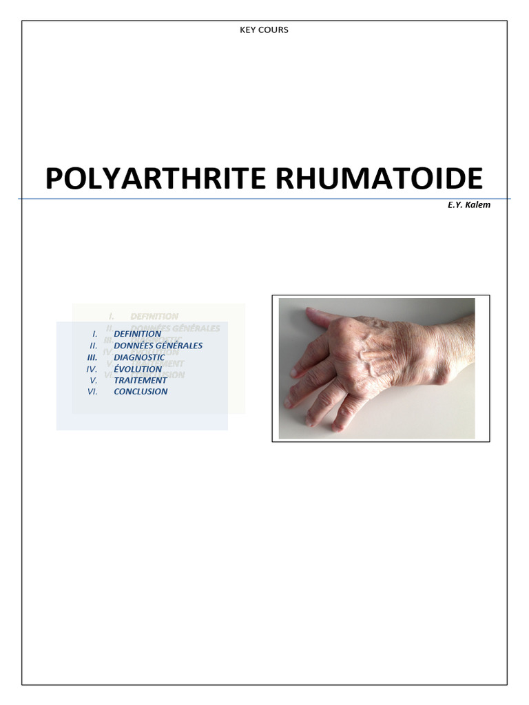 Comprendre la Polyarthrite Rhumatoïde | PDF | Polyarthrite rhumatoïde ...