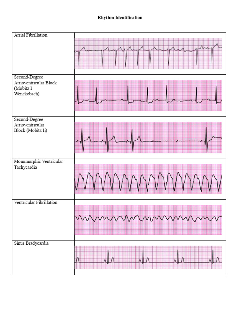 Rhythm Identification | PDF
