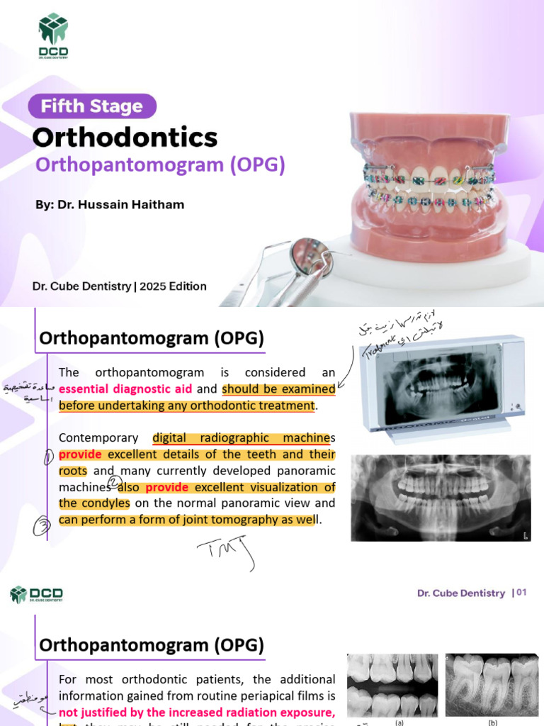 Updated Ortho5 Lec.4 Orthopantomogram OPG PDF | PDF | Medical ...