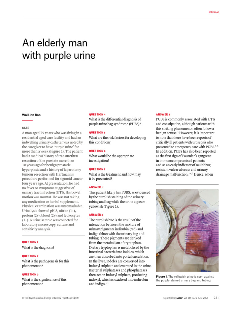 AJGP 06 2021 Clinical Boo Elderly Man Purple Urine WEB | PDF | Urinary ...