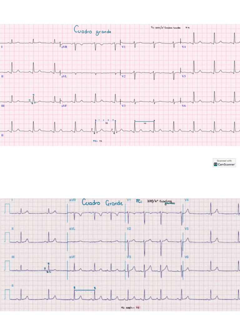 Electrocardiogram A | PDF