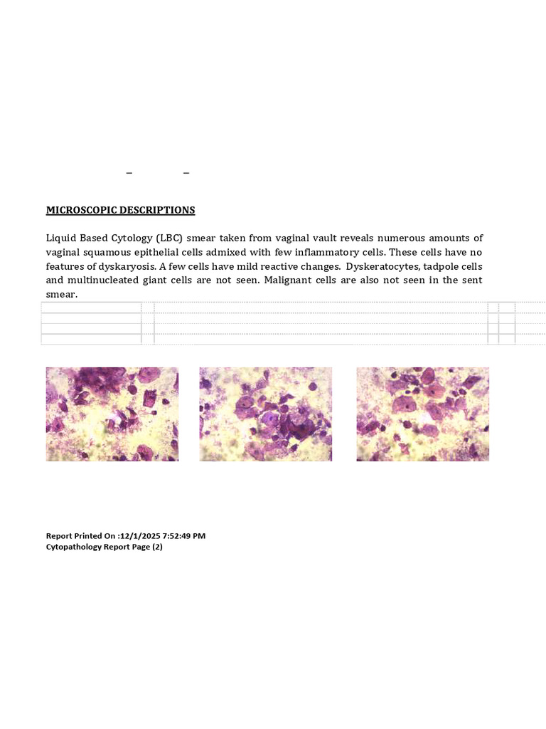 Daw Thidar Oo (Normal Vault Smear) | PDF