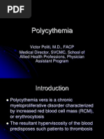 Polycythemia Vera: 2024 Diagnosis & Management | PDF