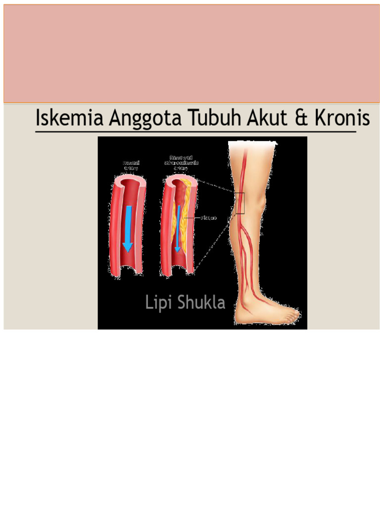 Presentasi Bedah Penyakit Vaskular Perifer | PDF