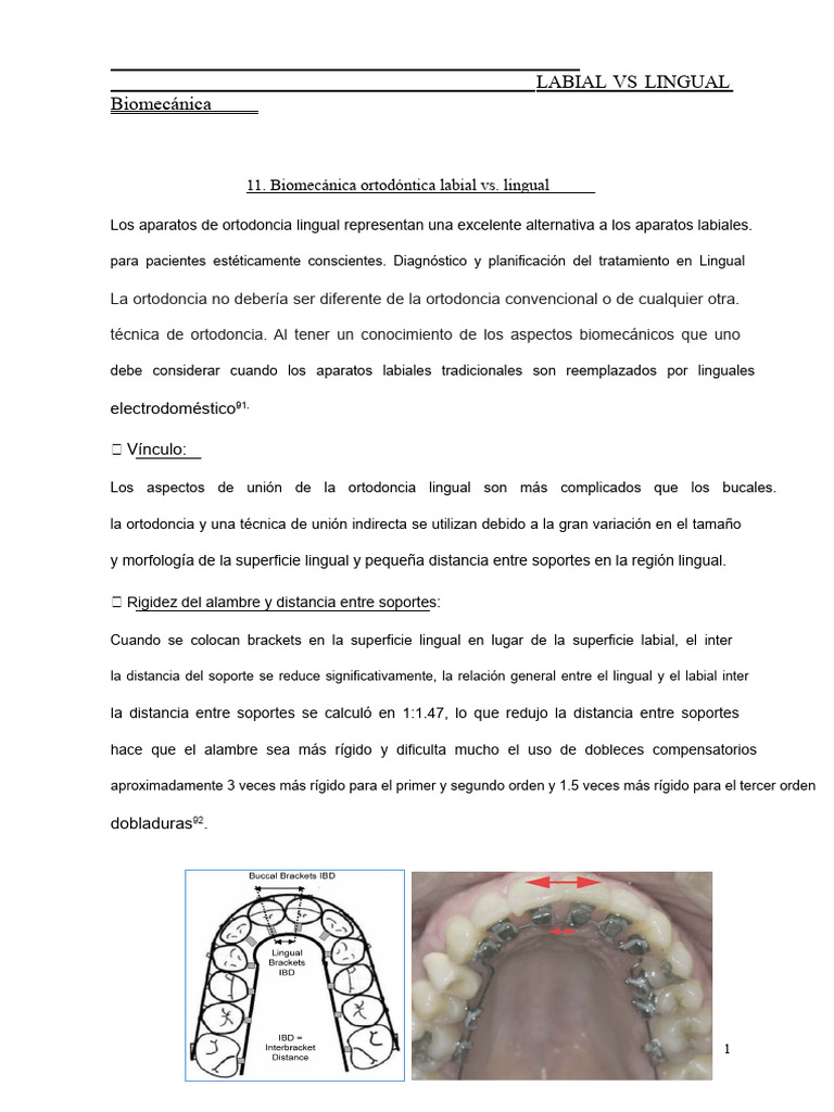 11.biomecánica Labial VS Lingual | PDF | Ortodoncia | Especialidades ...