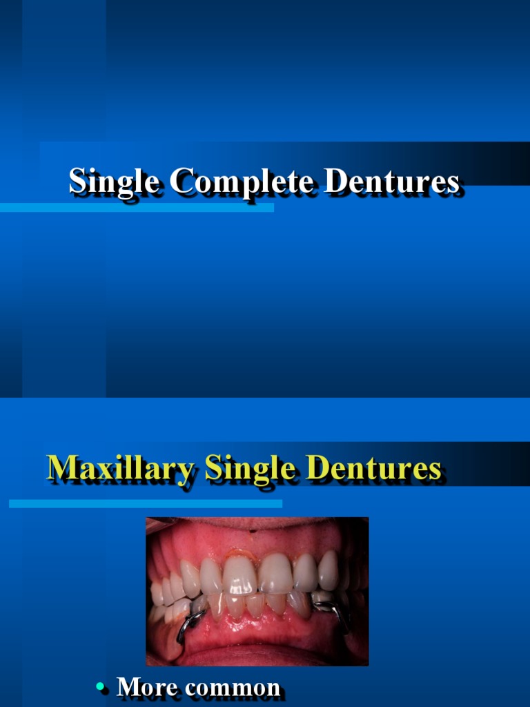 Single Complete Denture | PDF | Dentures | Mouth