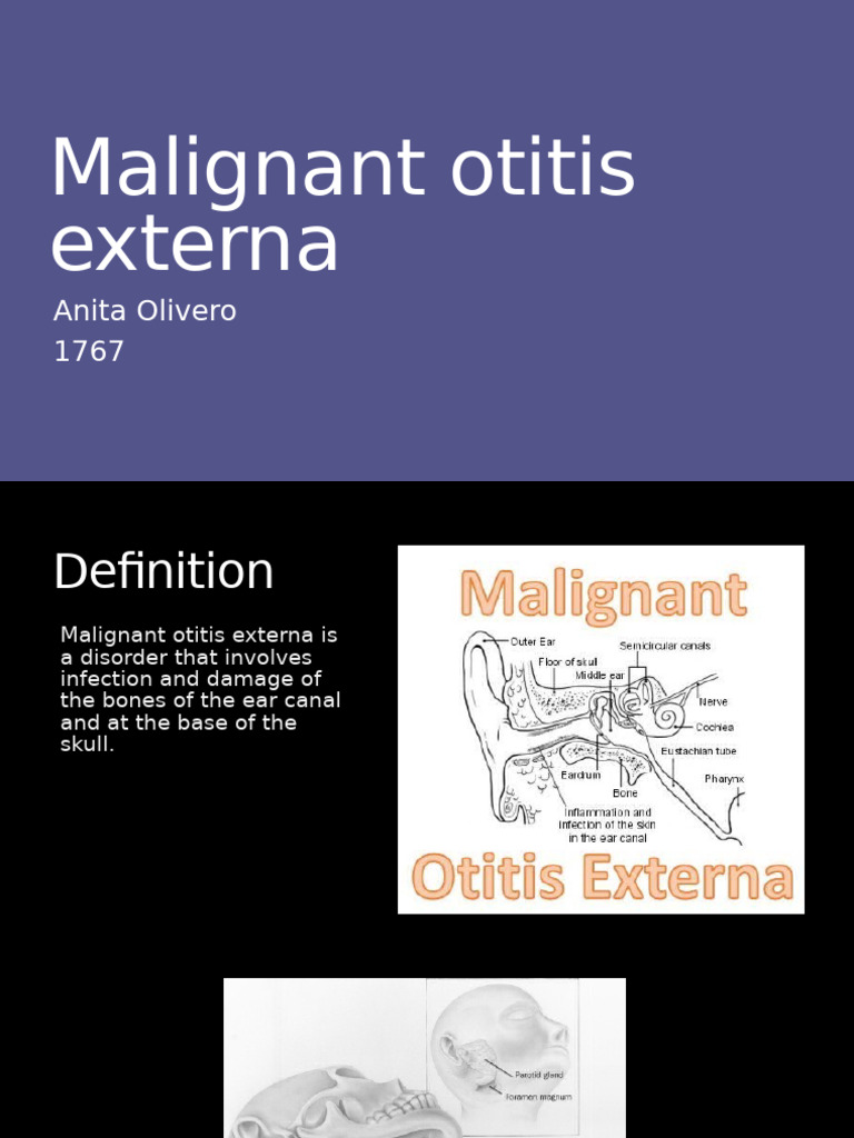 Malignant Otitis Externa Overview | PDF | Clinical Medicine | Human ...