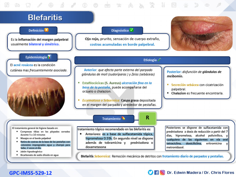 Blefaritis | PDF