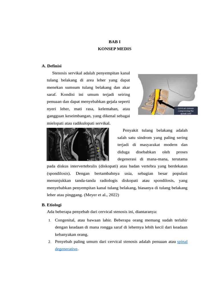Lp Servikal Stenosis Kanal | PDF