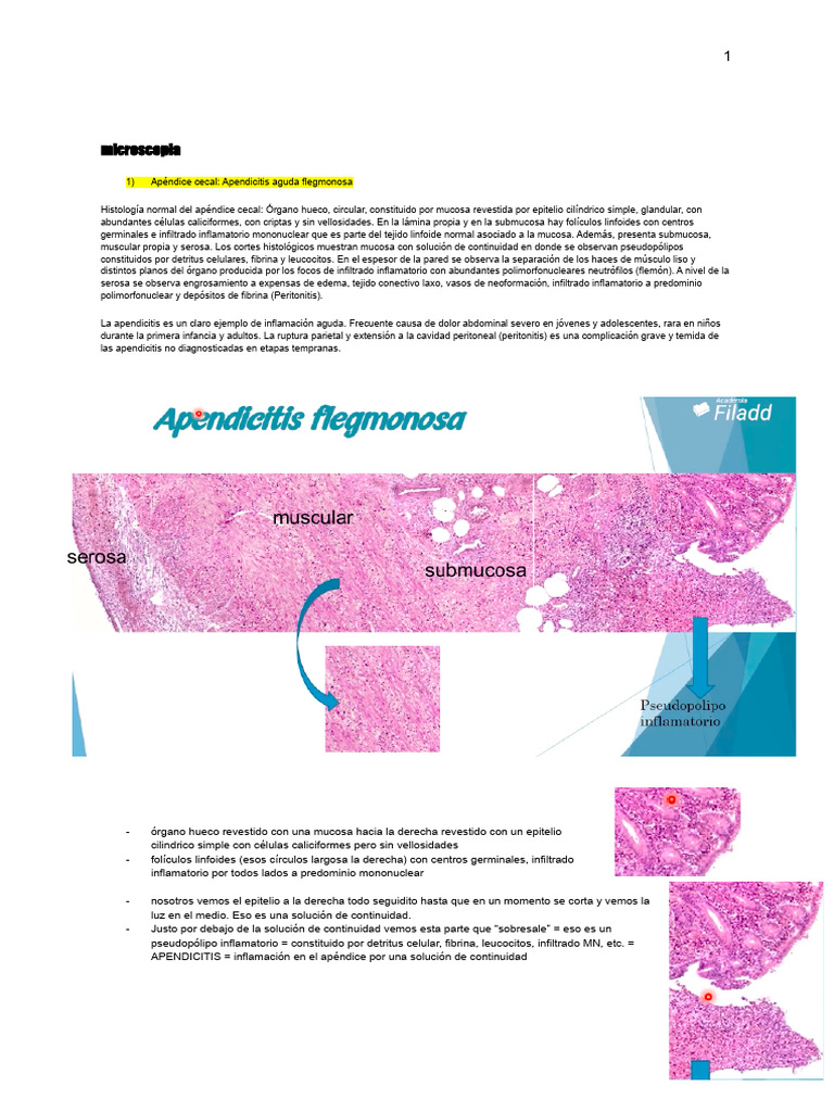 Practico Tp3_ | PDF | Inflamación | Epitelio