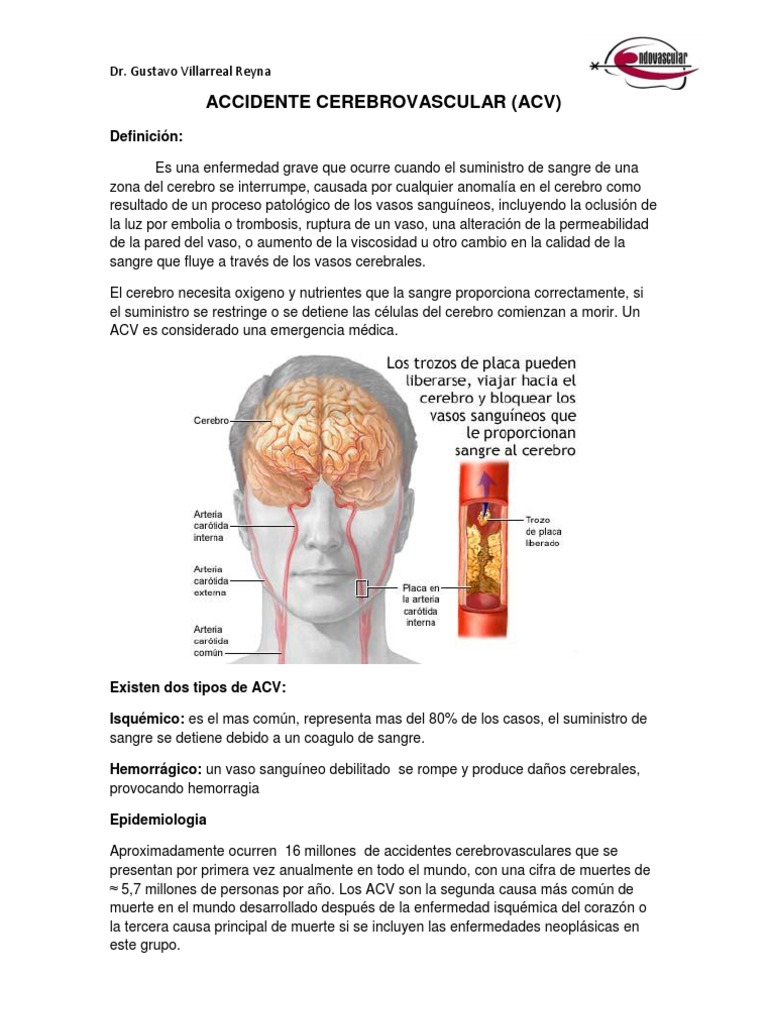 Accidente Cerebrovascular | PDF | Carrera | Isquemia