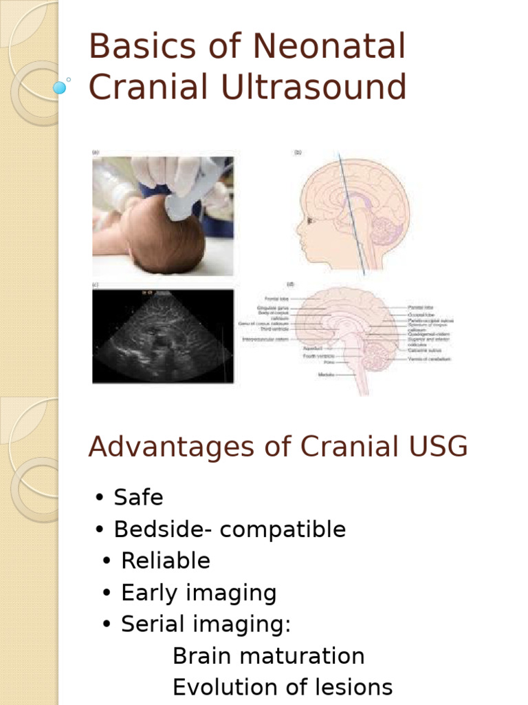 Neonatal Cranial Ultrasound Guide | PDF | Skull | Nervous System