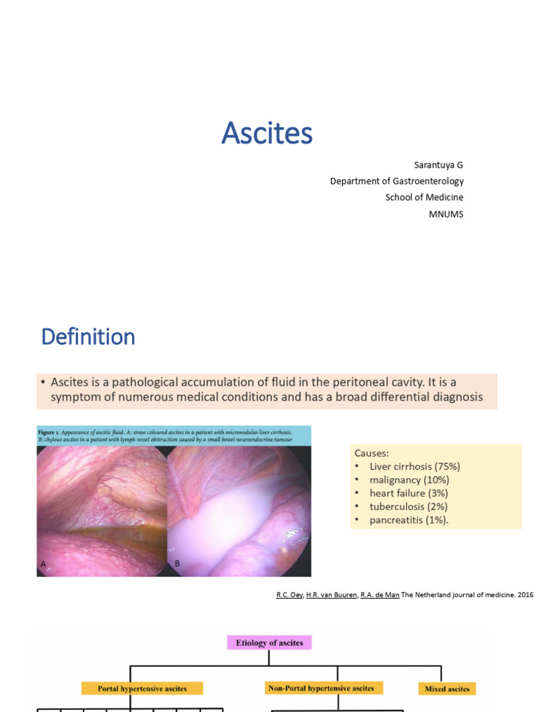 Ascites | PDF | Medical Specialties | Clinical Medicine