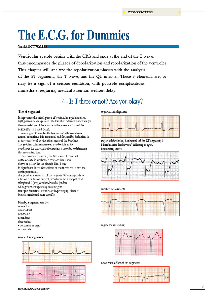 Understanding ECG Repolarization Phases | PDF | Electrocardiography ...