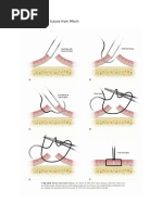 sBPE Guidelines for Periodontal Screening in Youth | PDF ...