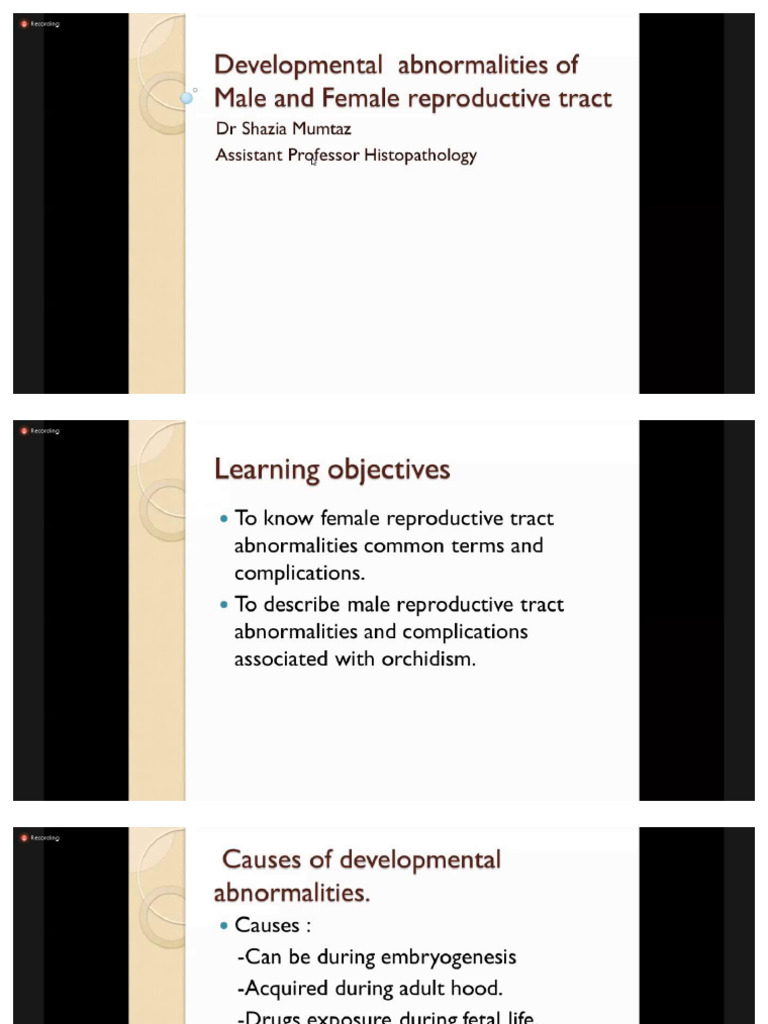 Developmental Disorders of Male & Female Genital Tract | PDF