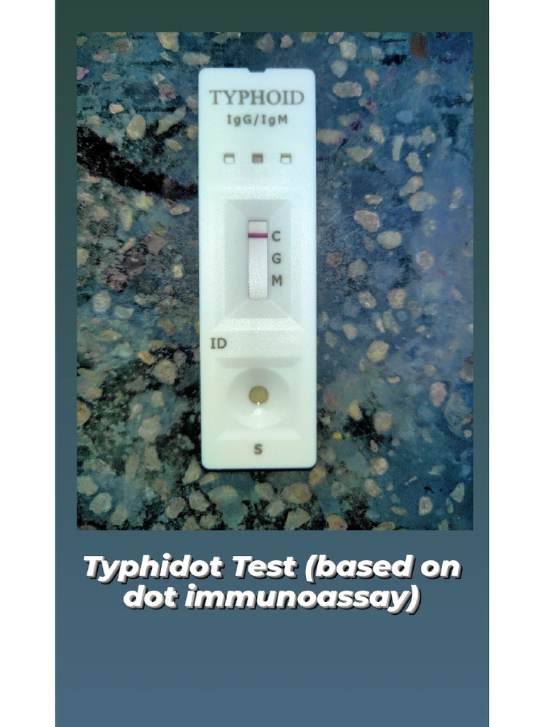 Serological Test (Micro) | PDF