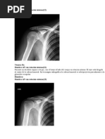 Signo del Perrito Escocés en Radiología | PDF | Vértebra | Medicina