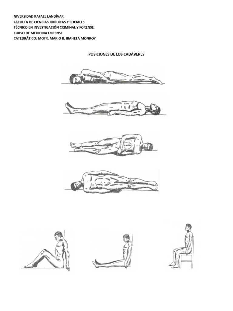 Posiciones Cadáveres en Escena (1) | PDF