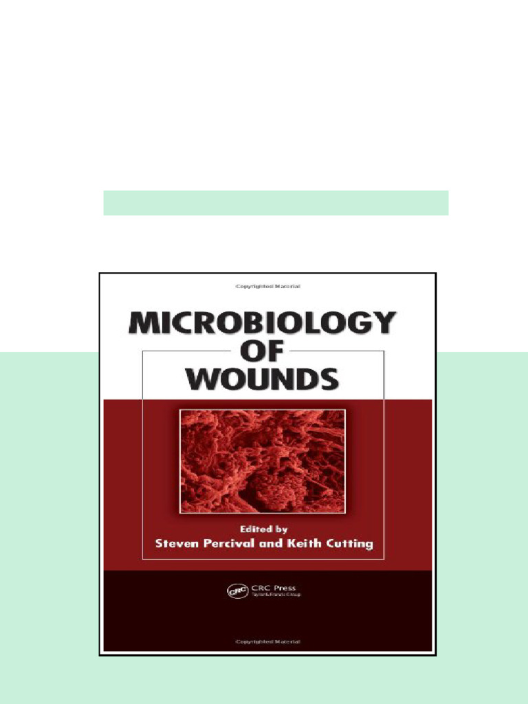 (Ebook) Microbiology of Wounds by Steven Percival, Keith Cutting ISBN ...
