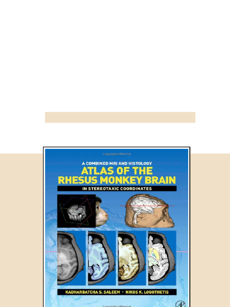 (Ebook) A Combined MRI and Histology Atlas of the Rhesus Monkey Brain ...