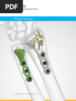 EVOS Wrist Surgical Technique Smith and Nephew | PDF | Drill | Screw