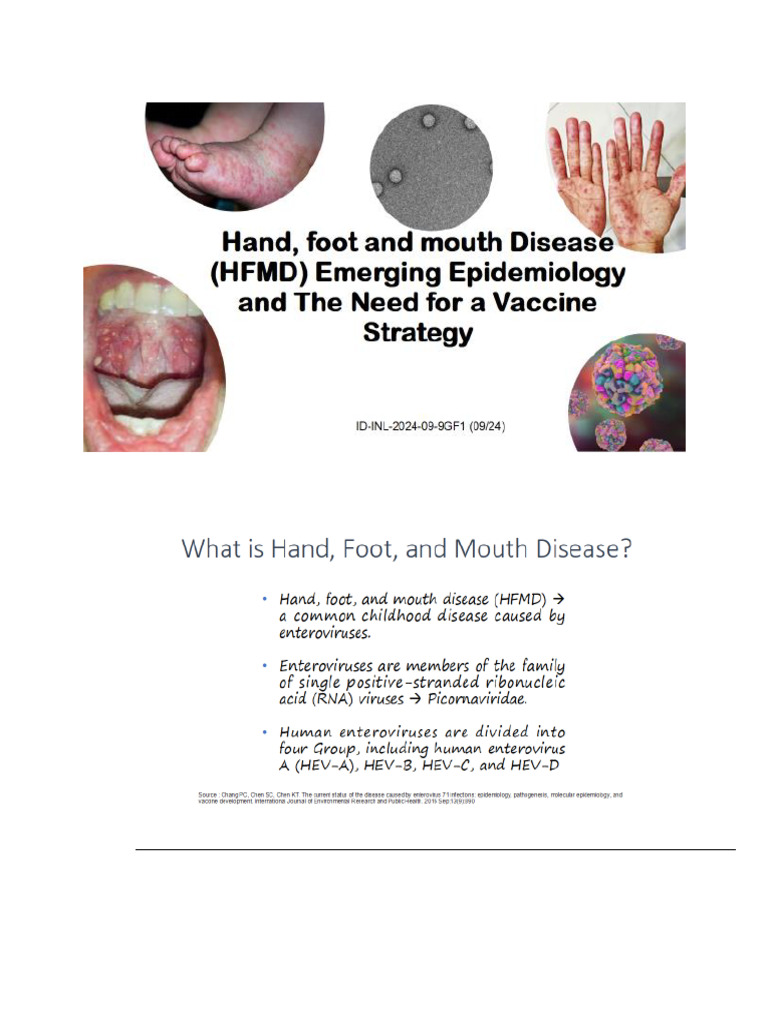 Hand Food Mouth Disease HFMD | PDF