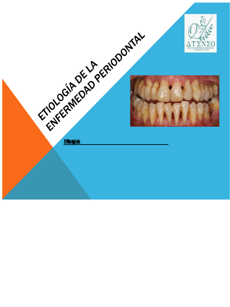 Etiology of Periodontal Disease | PDF | Periodontology | Oral Hygiene
