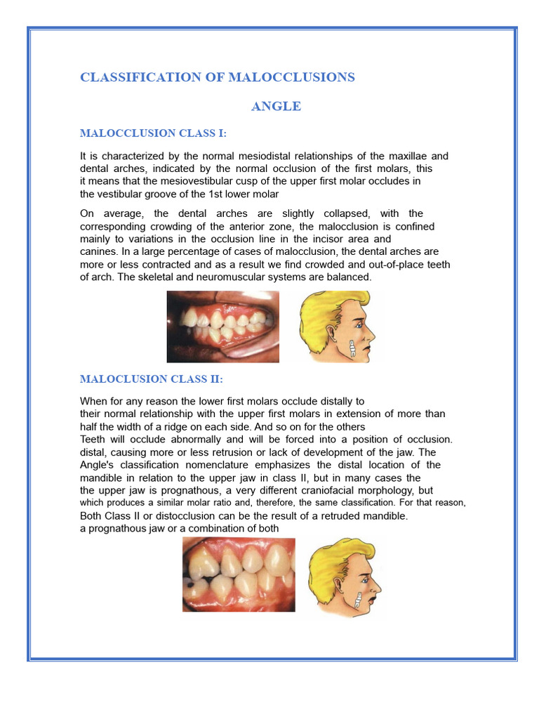 Understanding Malocclusion Classifications | PDF | Dentistry | Primate ...