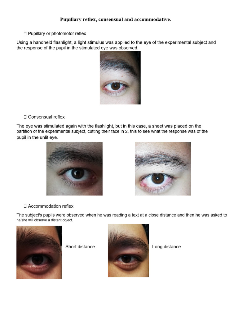PHYSIOLOGY PRACTICE. REFLEXES IN HUMANS | PDF | Visual System ...