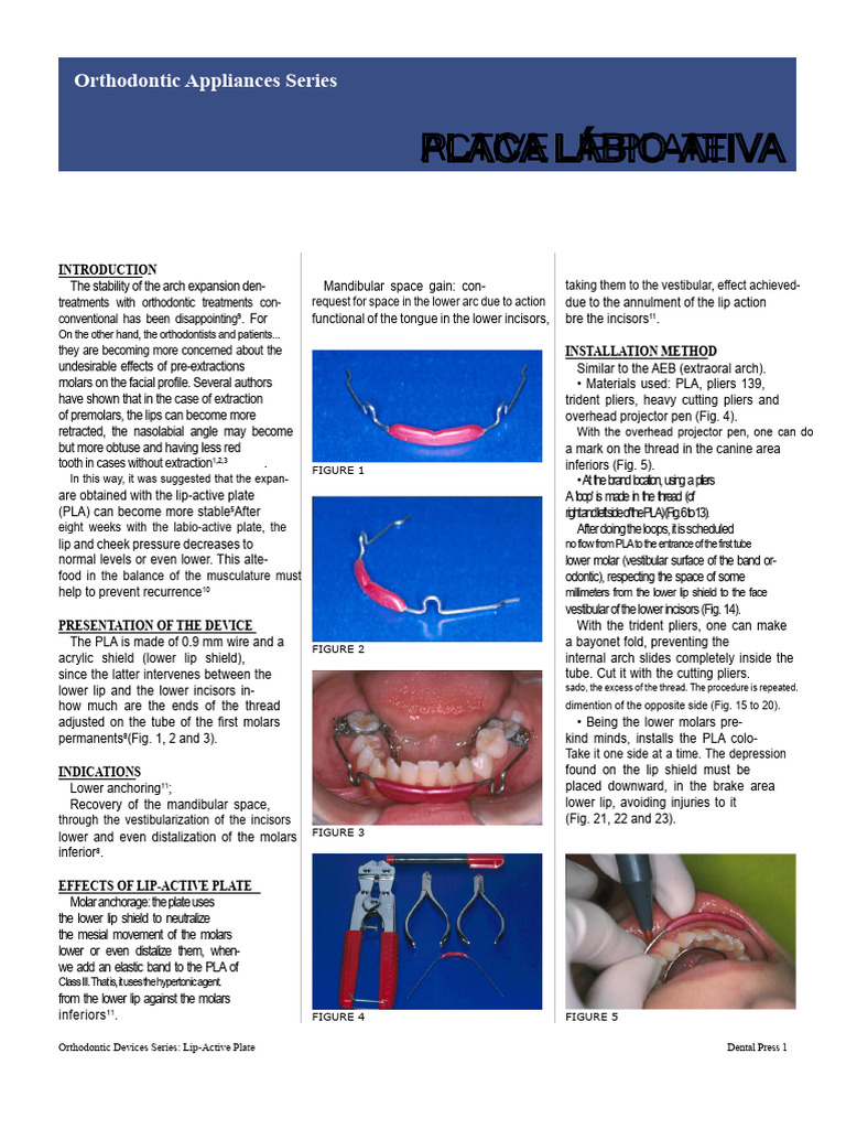 active_lip_plate | PDF | Orthodontics | Mouth