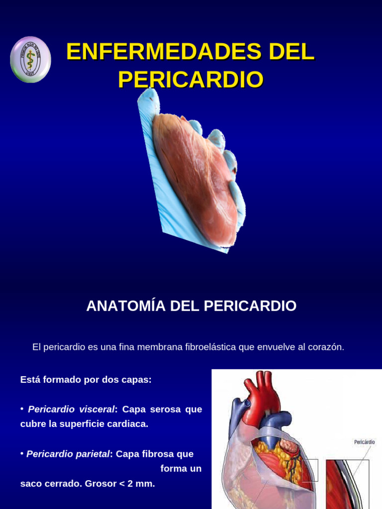 Pericardio Yogui | PDF | Enfermedades y trastornos | Especialidades Medicas